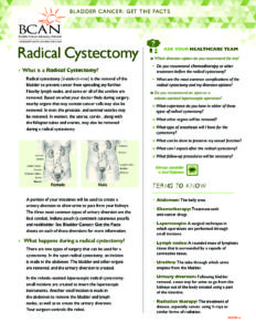 Radical Cystectomy – Bladder Cancer Advocacy Network